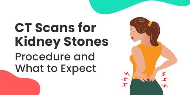 CT Scans for Kidney Stones: Procedure and What to Expect
