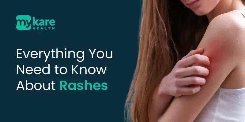 Everything You Need To Know About Rashes