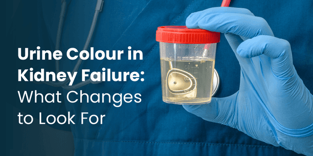 Color in Kidney Failure: What Changes to Look For