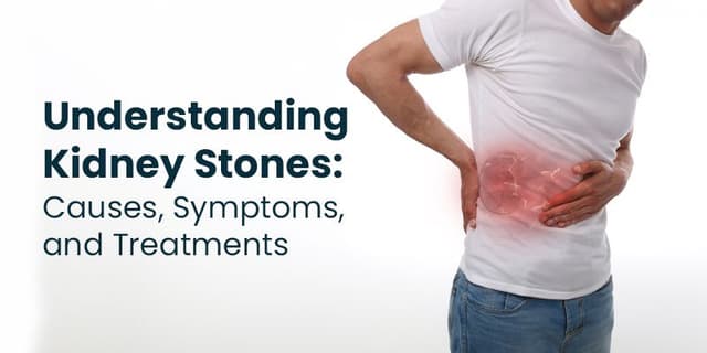 Understanding Kidney Stones: Causes, Symptoms, and Treatments