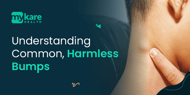 Understanding Common, Harmless Bumps
